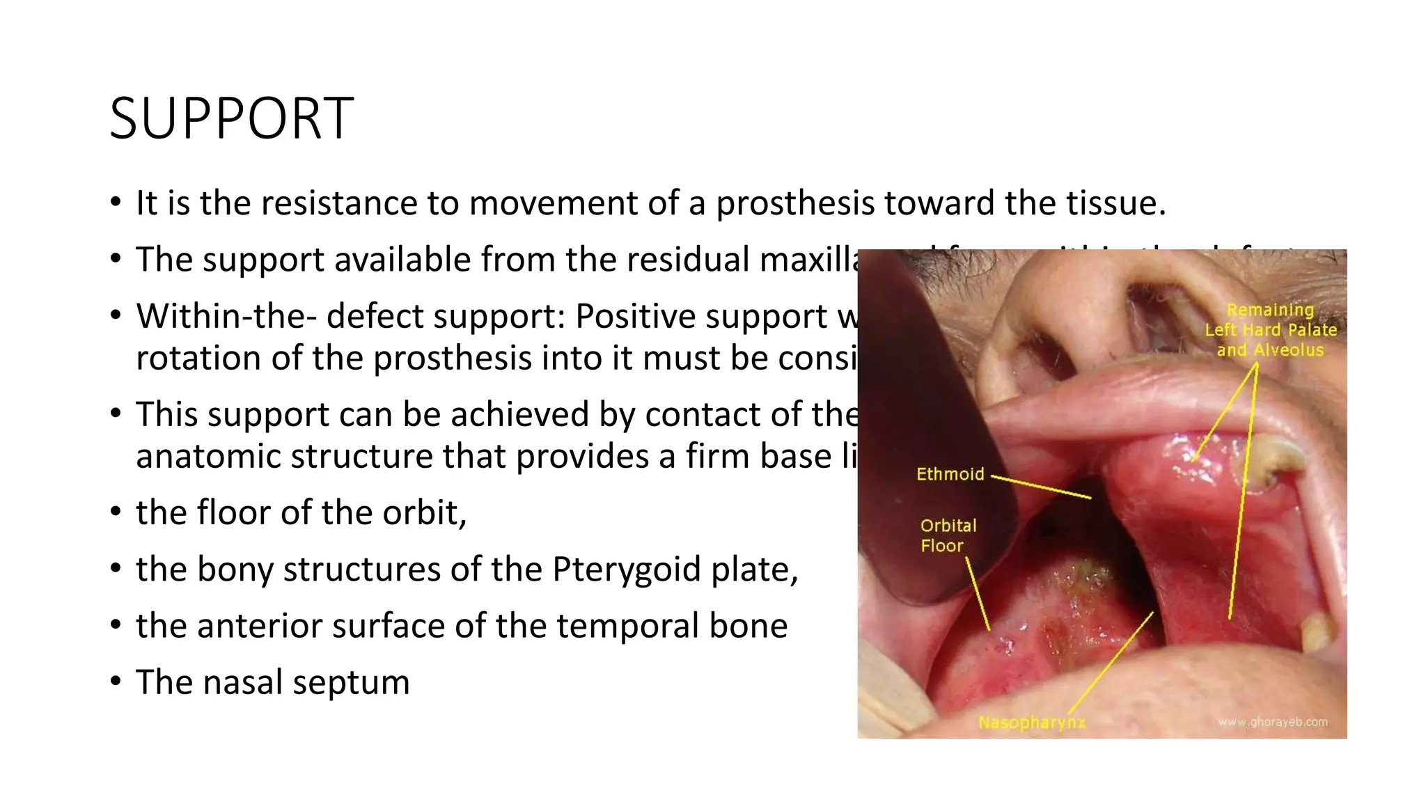 Retention in maxillofacial prosthesis pptx | PPTX