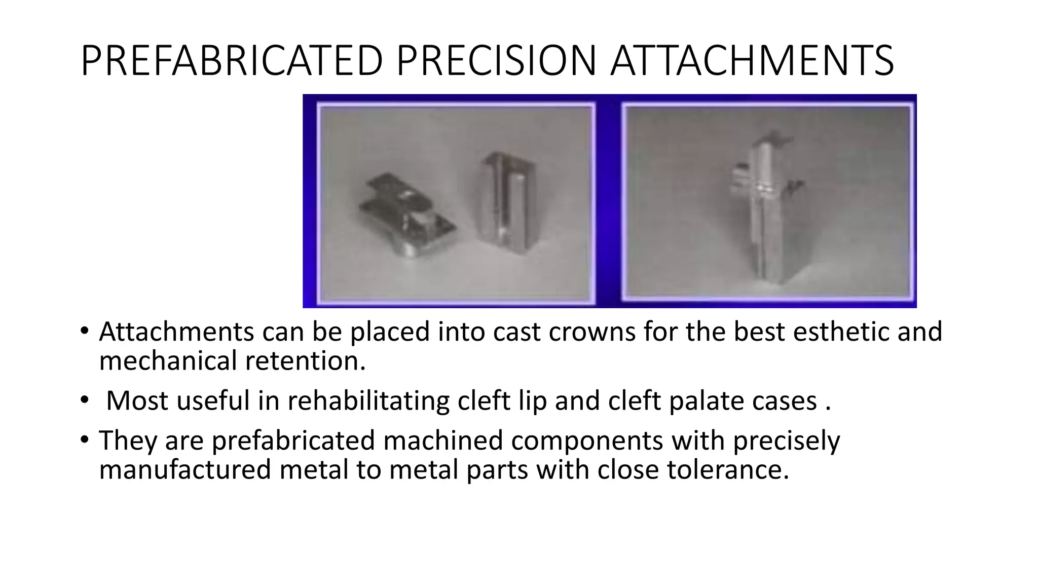 Retention in maxillofacial prosthesis pptx | PPTX