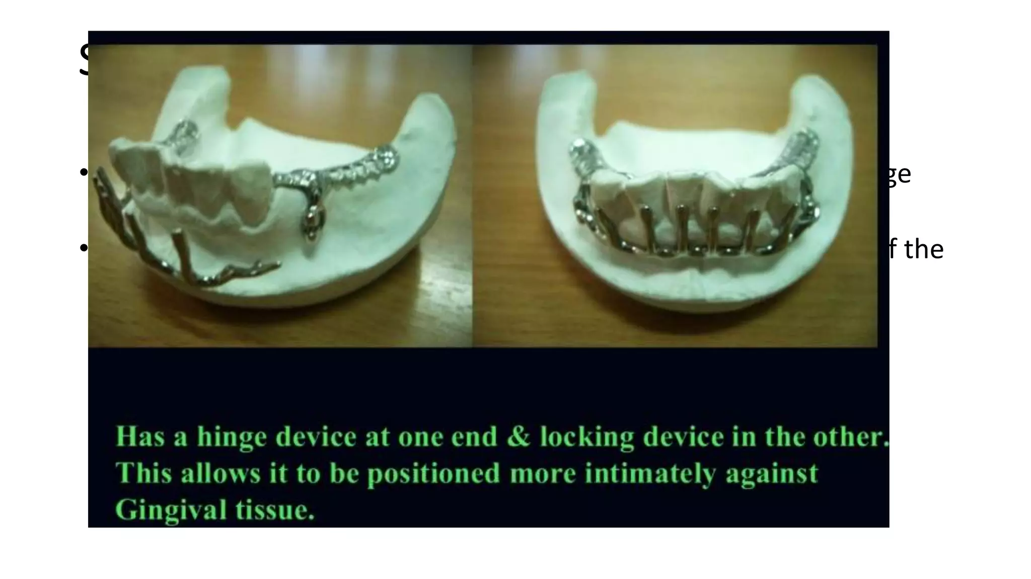 Retention in maxillofacial prosthesis pptx | PPTX