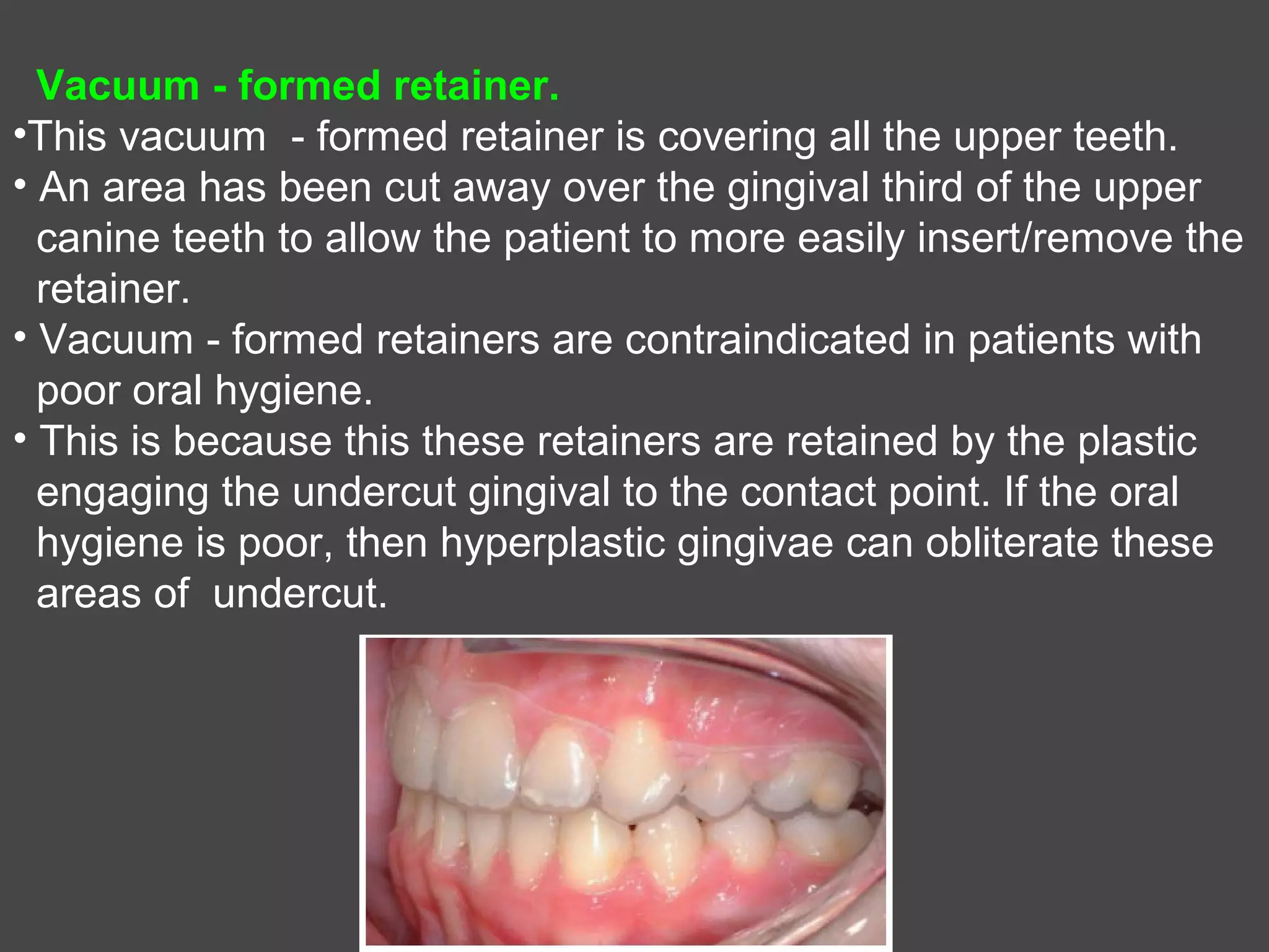 Retention in orthodontics | PPT