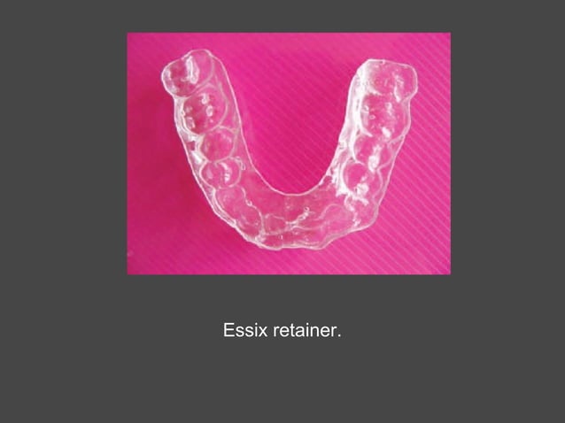Retention in orthodontics | PPT