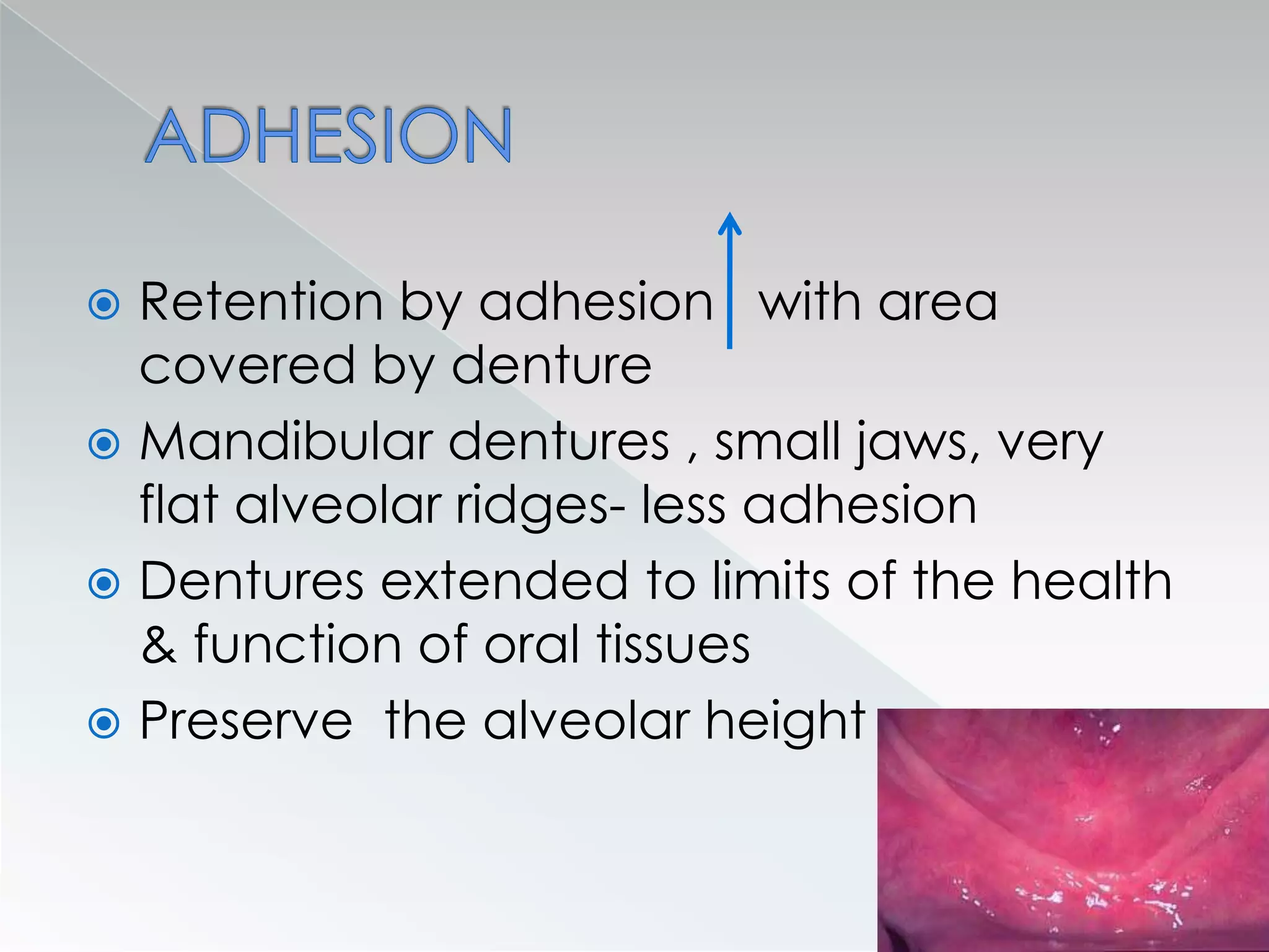 Retention of complete dentures | PPTX
