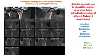 Retention of open bite | PPTX