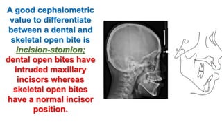 Retention of open bite | PPTX