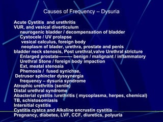 Retention of urine | PPT