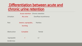 Retention of urine | PPTX