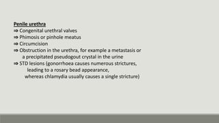 Retention of urine | PPTX