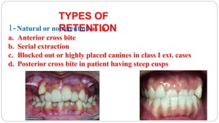Retention & relapce in orthodontics.pptx