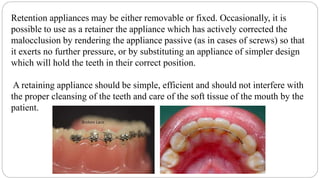 Retention & relapce in orthodontics.pptx