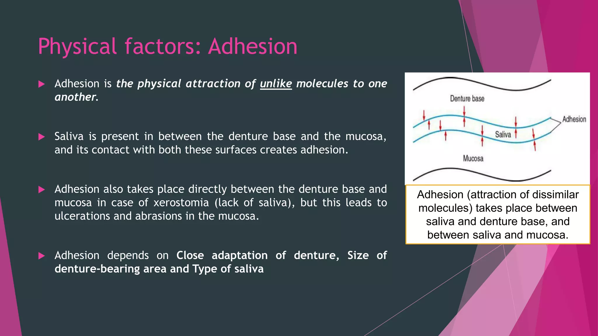 Retention, Stability and Support in Complete Dentures | PDF