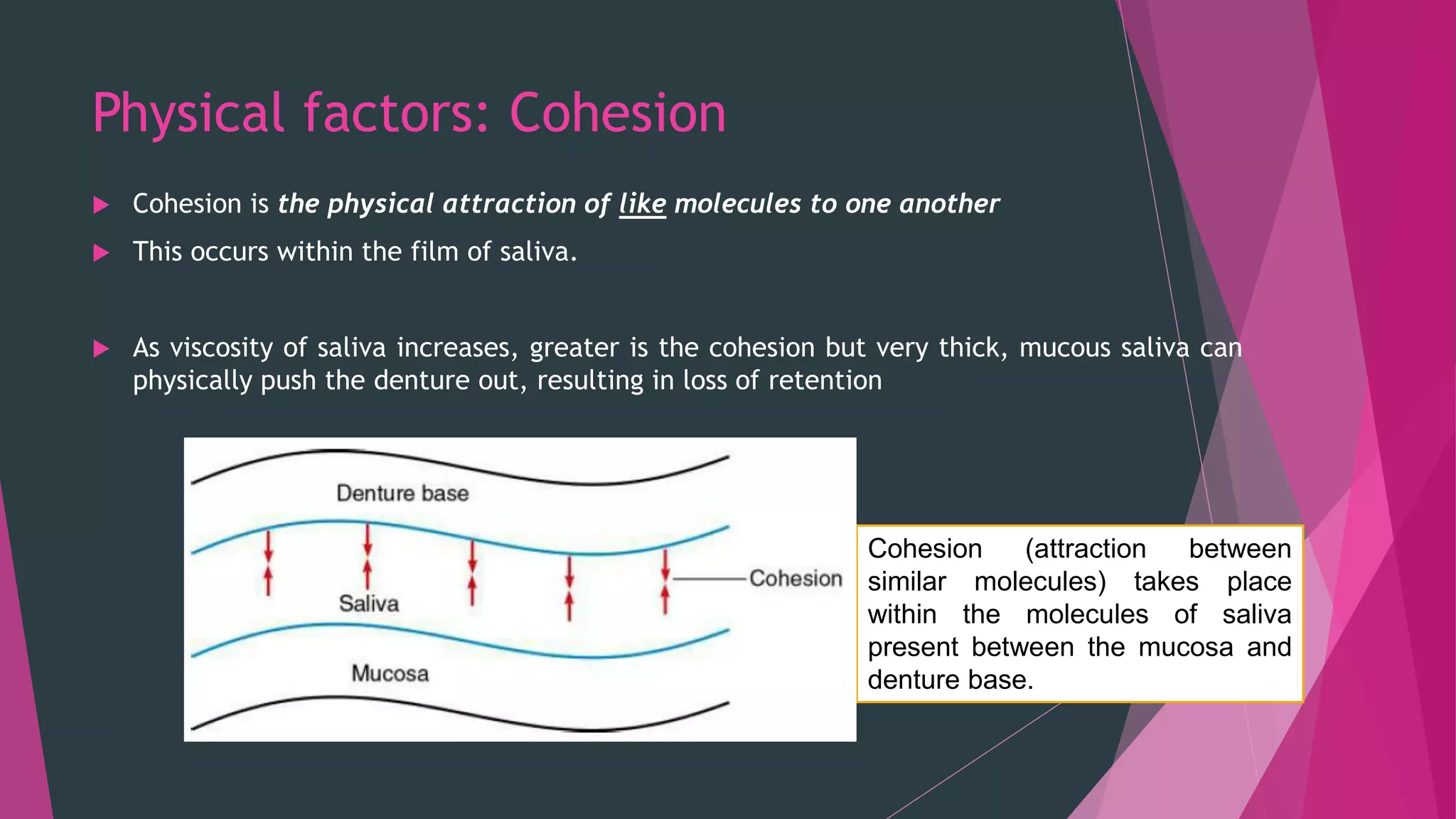 Retention, Stability and Support in Complete Dentures | PDF