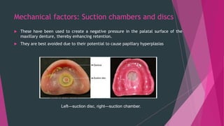 Retention, Stability and Support in Complete Dentures | PDF