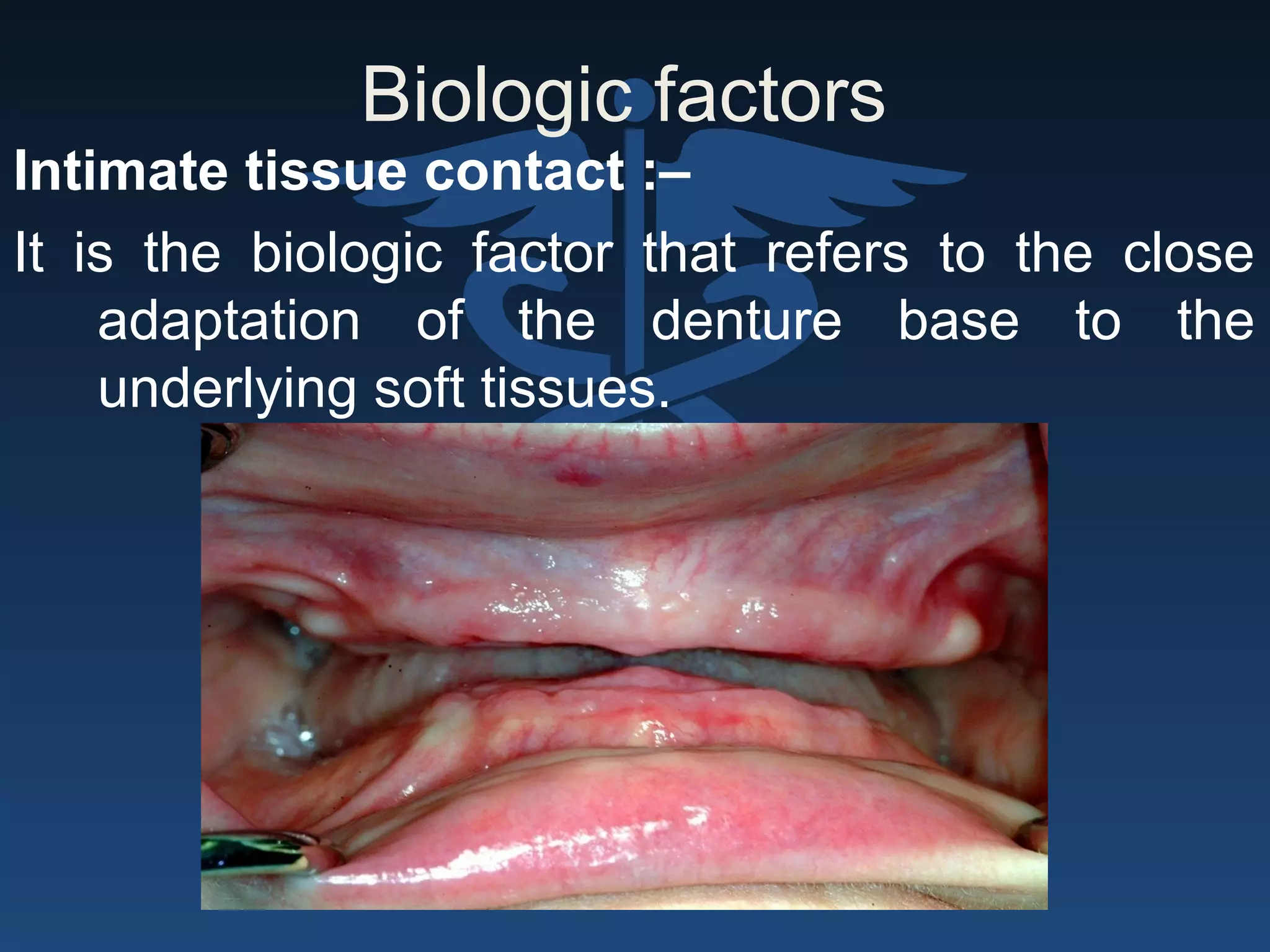 Retention stability support in complete dentures | PPT