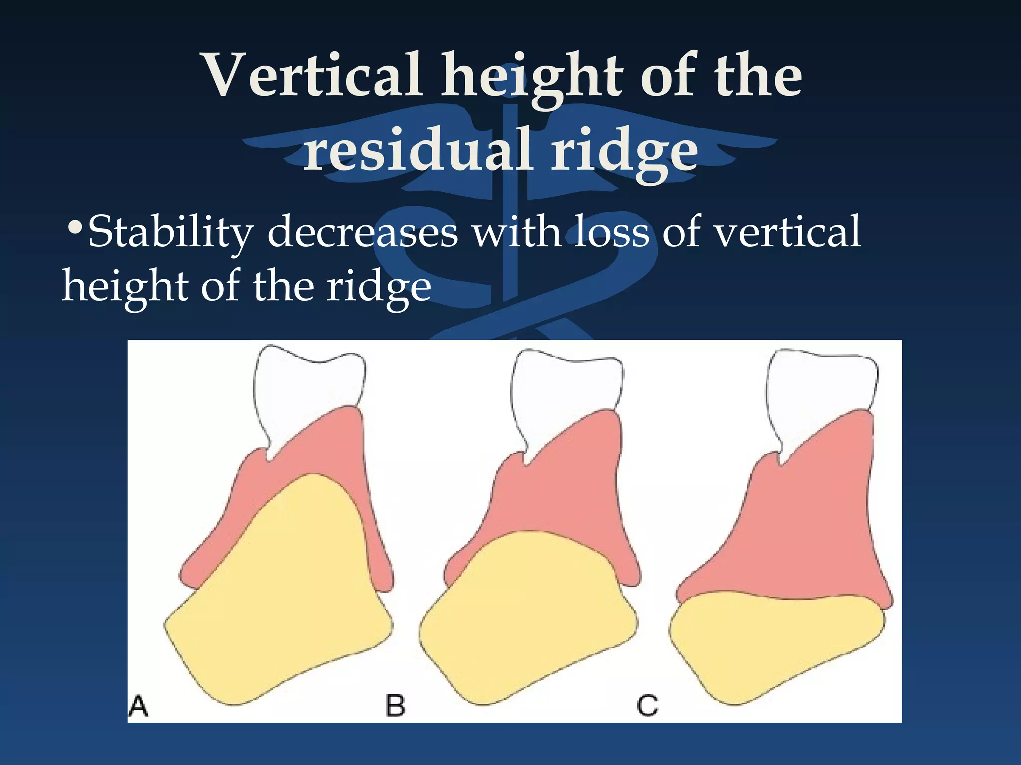 Retention stability support in complete dentures | PPT