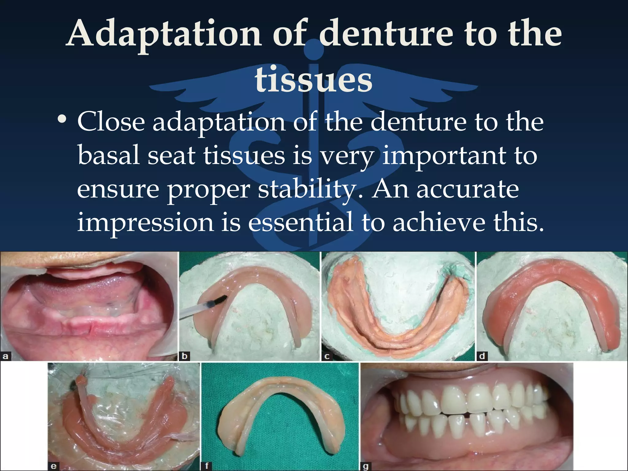 Retention stability support in complete dentures | PPT