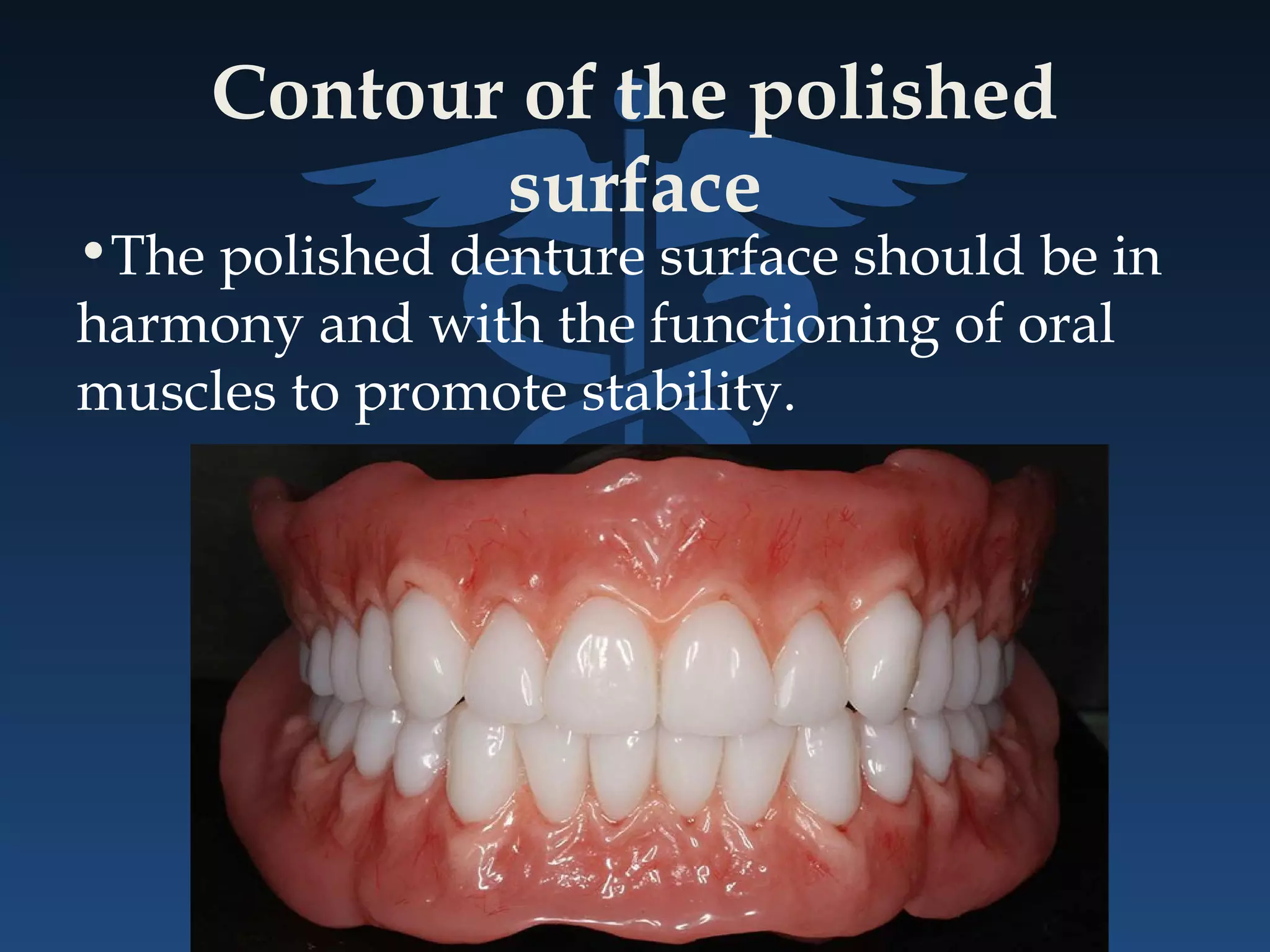 Retention stability support in complete dentures | PPT
