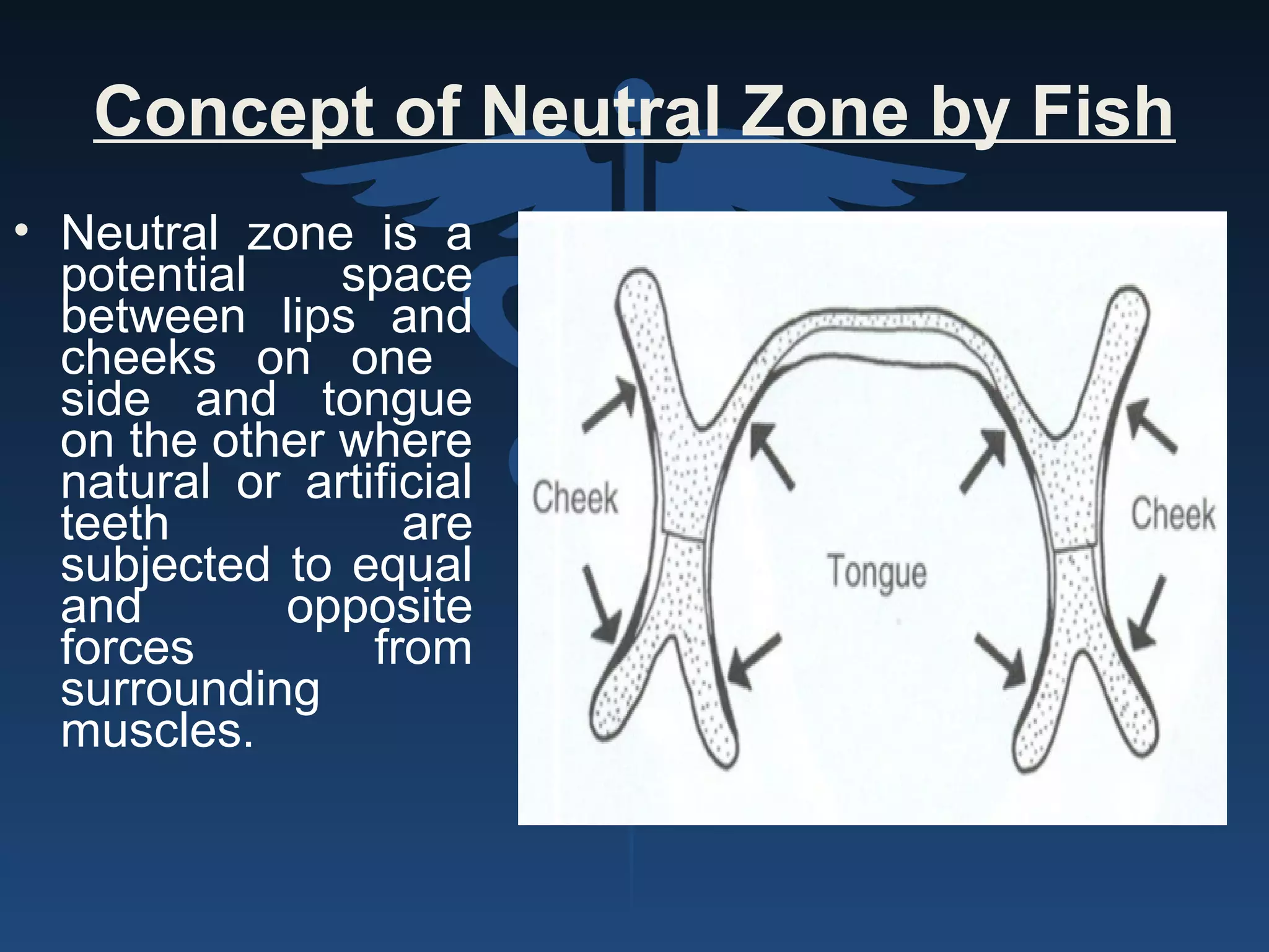 Retention stability support in complete dentures | PPT