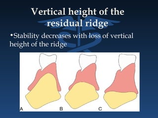Retention stability support in complete dentures | PPT