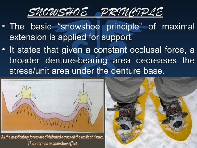 Retention stability support in complete dentures | PPT | Dental Health ...