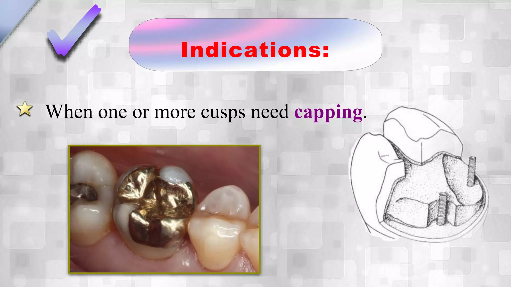 Indications and Contraindications of Retentive pins | PPT