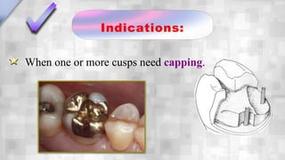 Indications and Contraindications of Retentive pins | PPSX