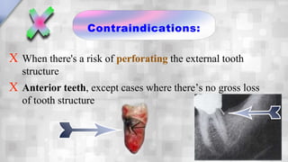 Indications and Contraindications of Retentive pins | PPT