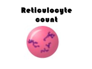 Reticulocyte count | PPT
