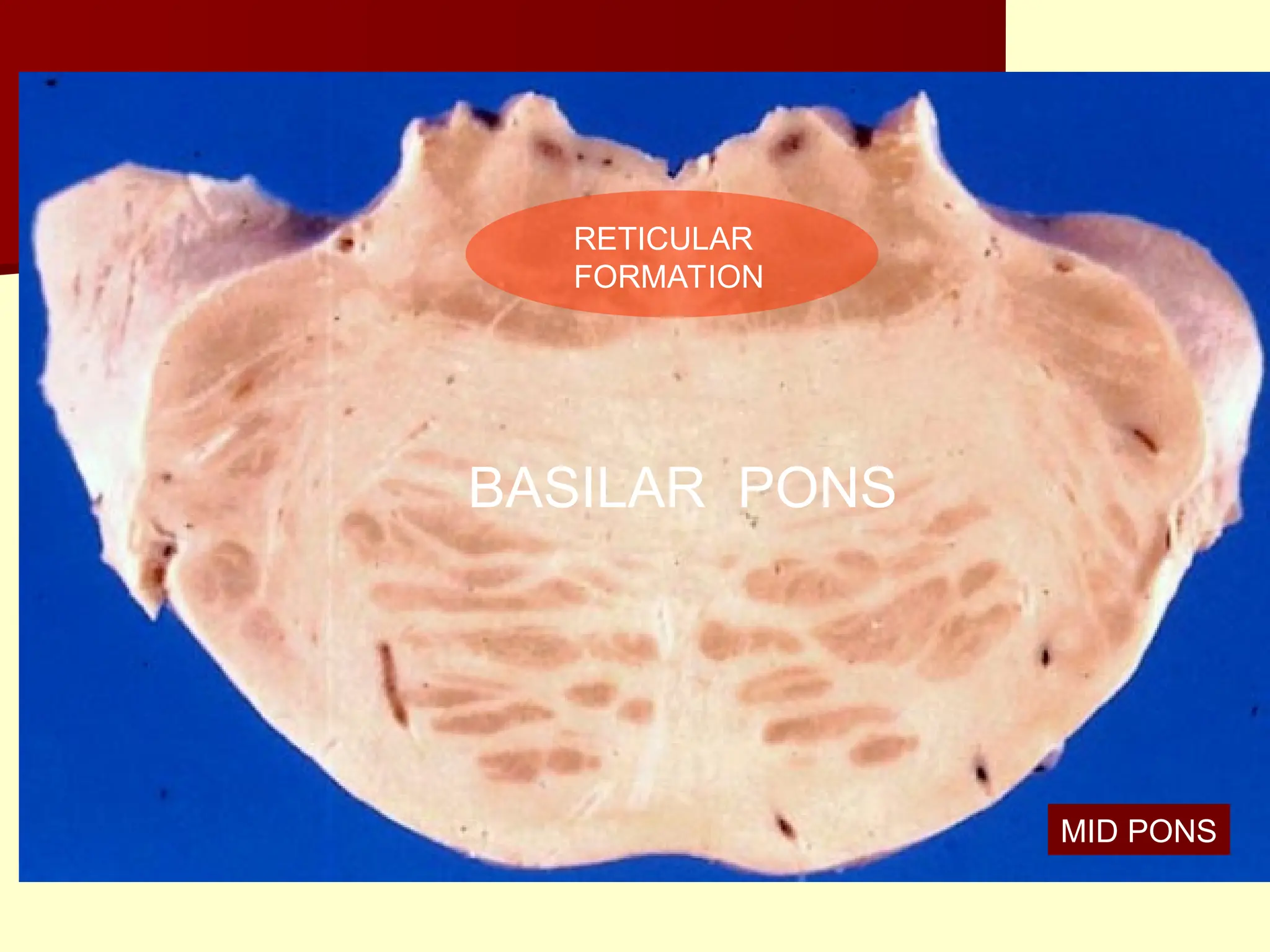 RETICULAR FORMATION.ppt okkkkkkkkkkkkkkkkkk | PPT