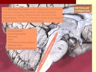 RETICULAR FORMATION.ppt okkkkkkkkkkkkkkkkkk | PPT