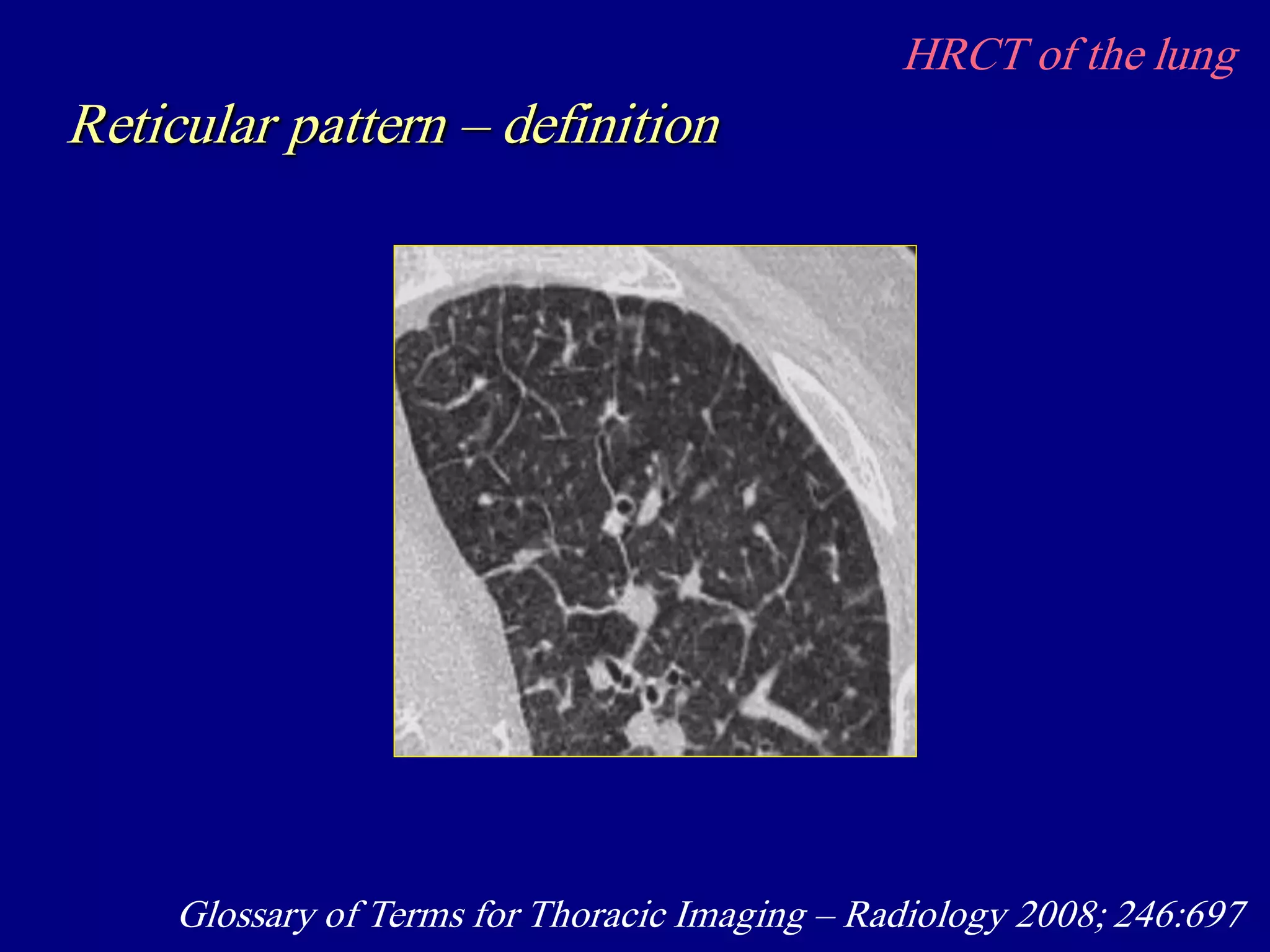 Reticular pattern | PDF
