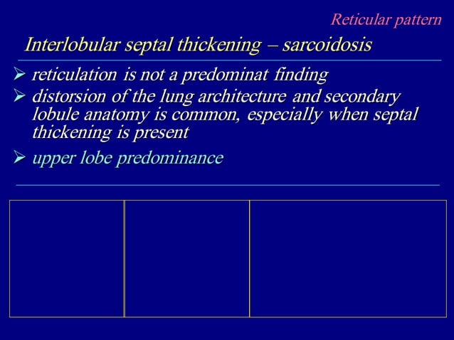 Reticular pattern | PDF | Lung and Respiratory Health | Diseases and ...