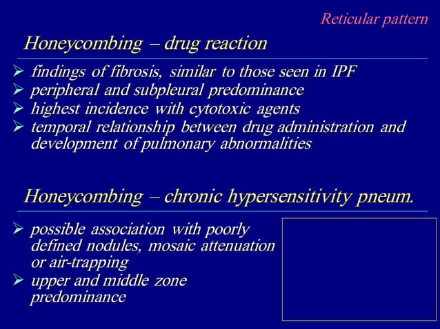 Reticular pattern | PDF | Lung and Respiratory Health | Diseases and ...