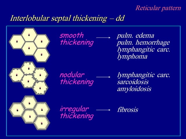 Reticular pattern | PDF | Lung and Respiratory Health | Diseases and ...