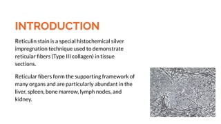Reticulin Stain (Gordon & Sweet Method) | Special Stain in ...