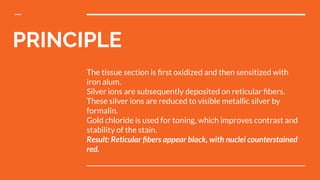 Reticulin Stain (Gordon & Sweet Method) | Special Stain in ...