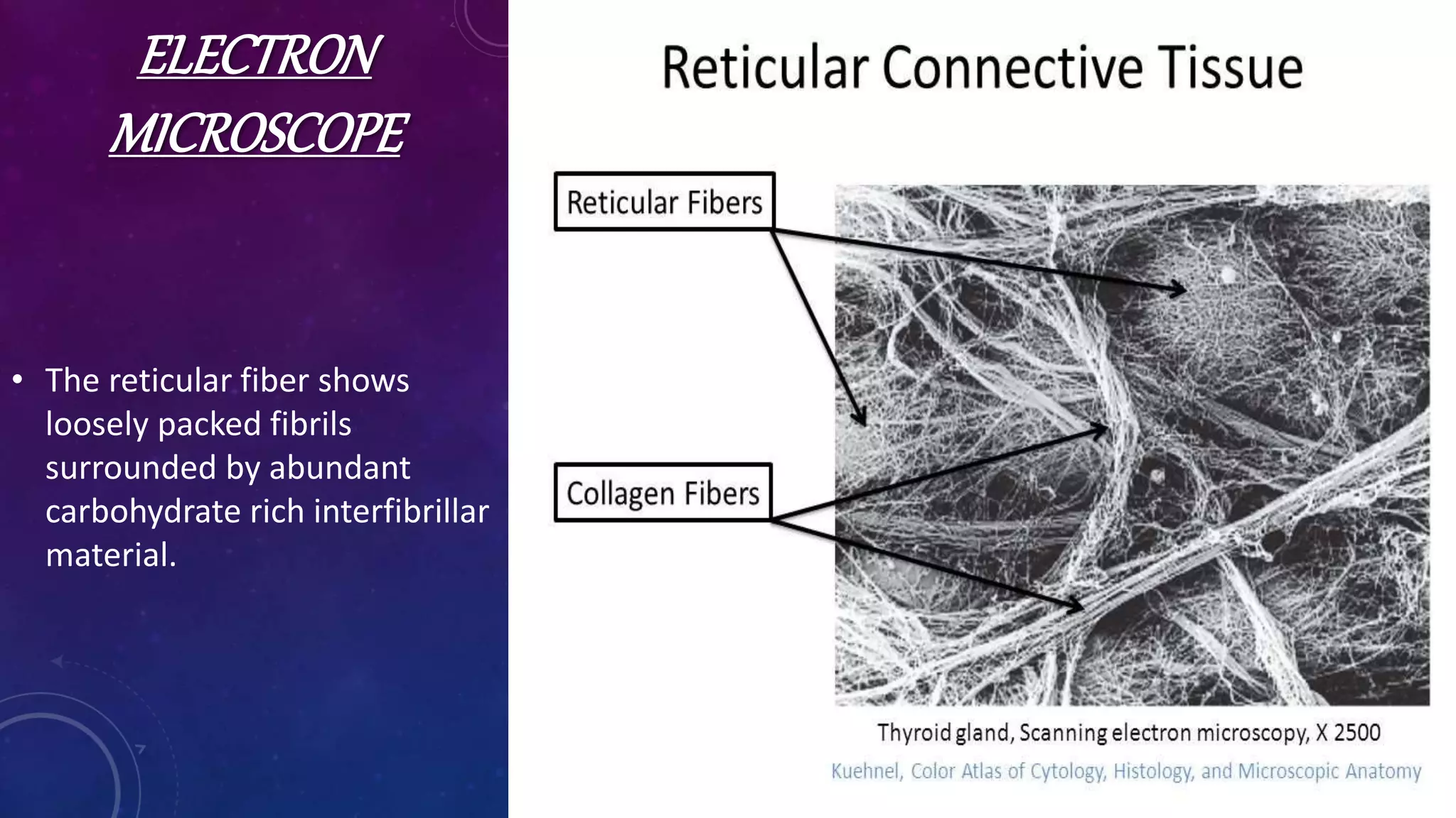 Reticulin Fibers | PPTX
