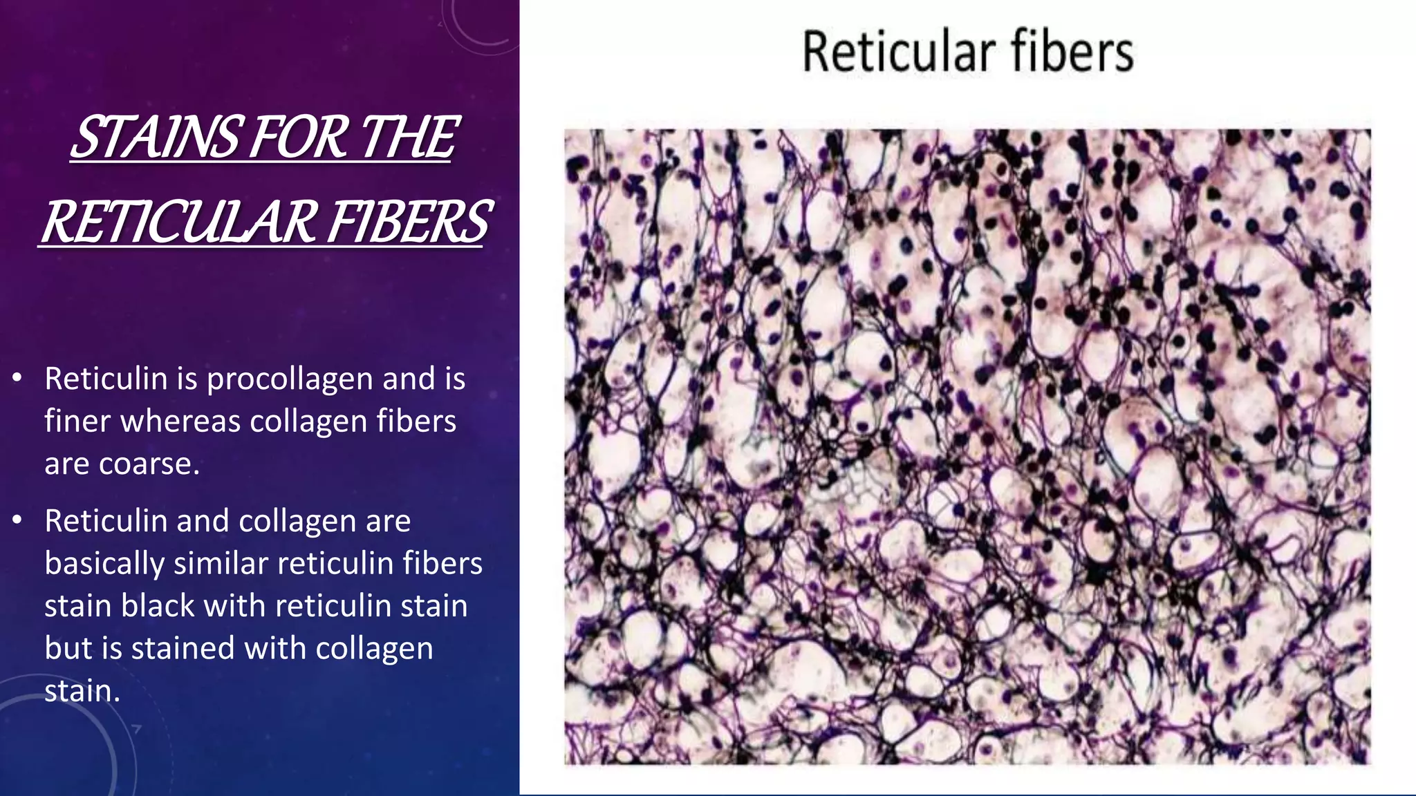 Reticulin Fibers | PPTX