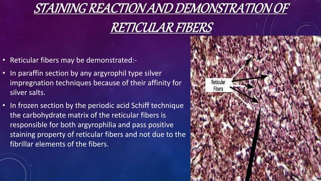 Reticulin Fibers | PPTX | Commodities | Economy