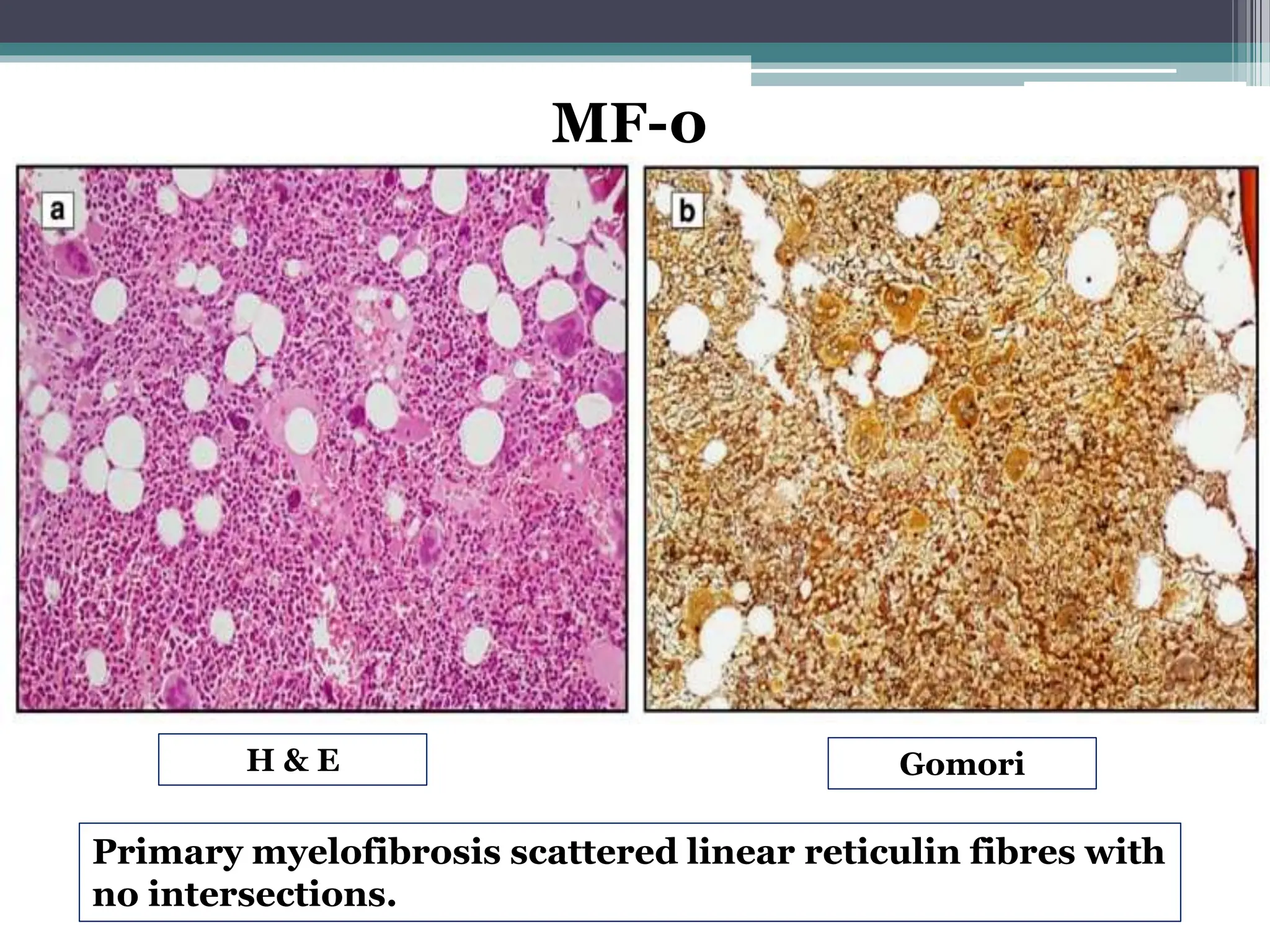 RETICULIN STAIN SEMINAR 24.5.pptx