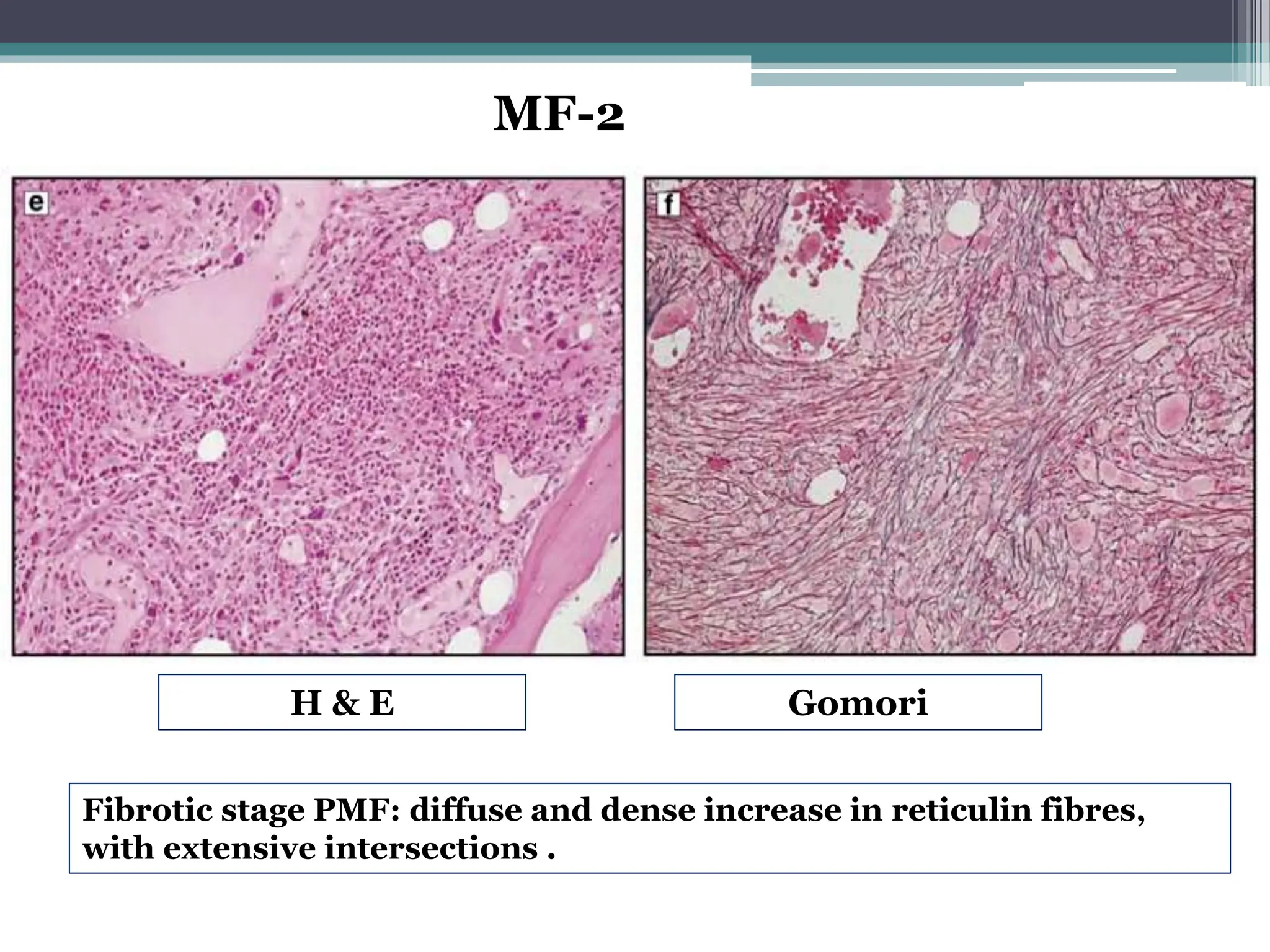 RETICULIN STAIN SEMINAR 24.5.pptx