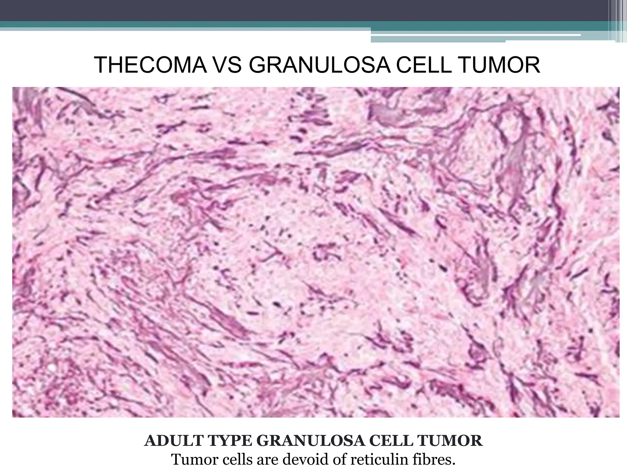 RETICULIN STAIN SEMINAR 24.5.pptx