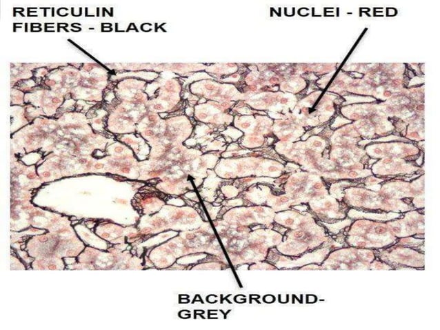 RETICULIN STAIN SEMINAR 24.5.pptx