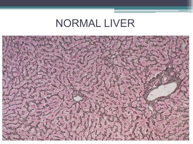 RETICULIN STAIN SEMINAR 24.5.pptx