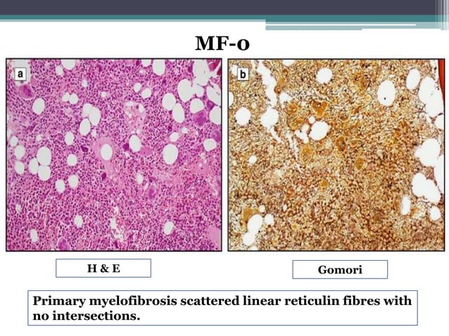 RETICULIN STAIN SEMINAR 24.5.pptx