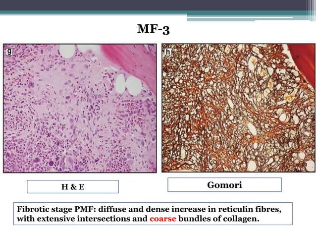 RETICULIN STAIN SEMINAR 24.5.pptx