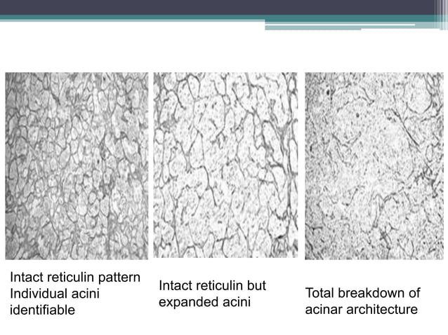 RETICULIN STAIN SEMINAR 24.5.pptx