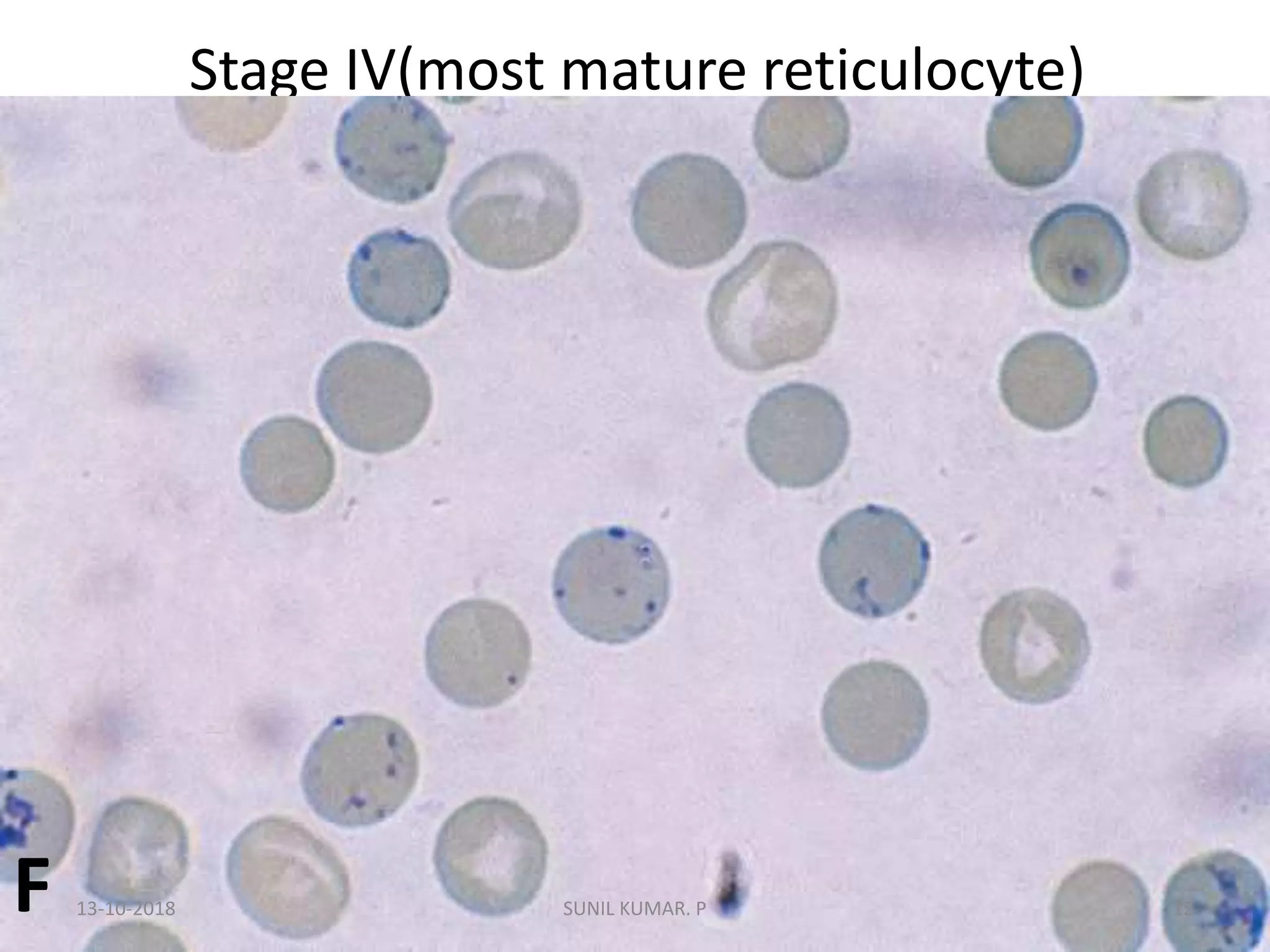 Reticulocyte count | PPTX