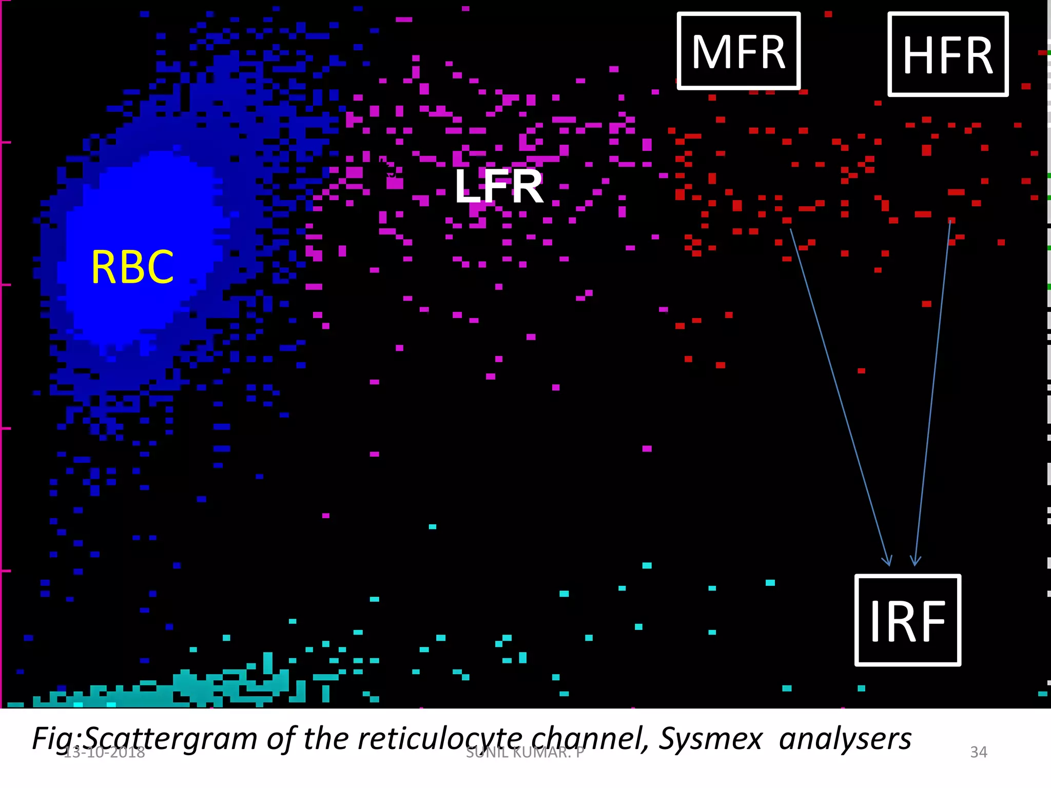 Reticulocyte count | PPTX