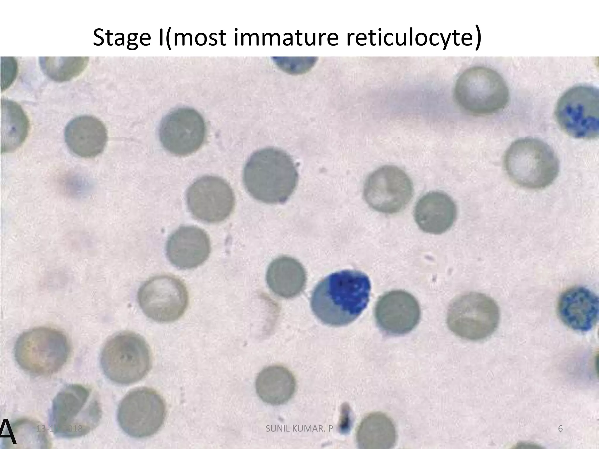Reticulocyte count | PPTX