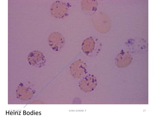 Reticulocyte Vs Heinz Body
